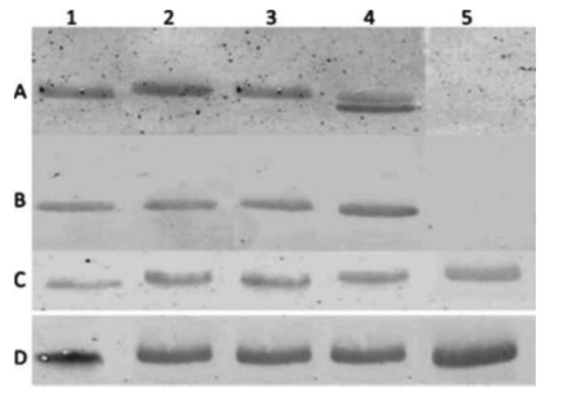 Western blots – Science Integrity Digest