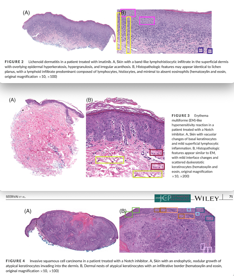 Concerns about 12 MD Anderson Cancer Center’s Pathology Papers ...
