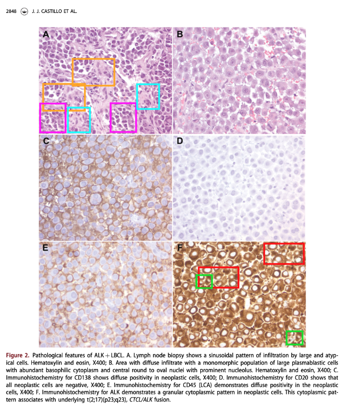 Concerns about 12 MD Anderson Cancer Center’s Pathology Papers ...