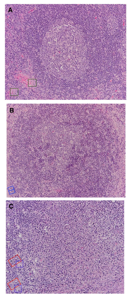 Concerns about 12 MD Anderson Cancer Center’s Pathology Papers ...